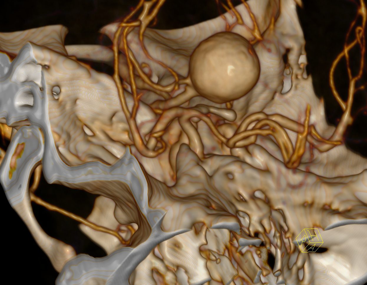 Angiografia CT - MEDINST